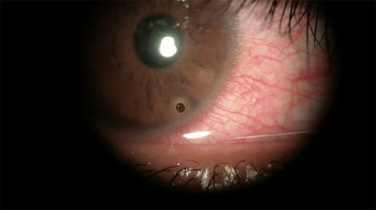 Eye Exams - Hugo Higa, MD - Eyelid and Facial Surgery